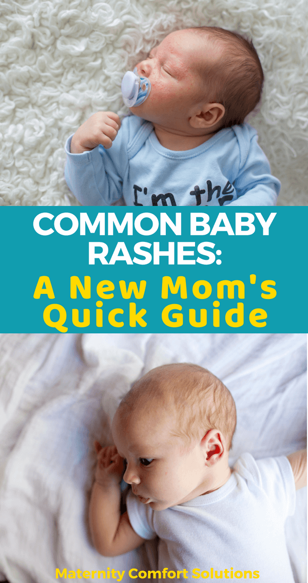 11 Common Baby Rashes: A Mom’s Quick Guide