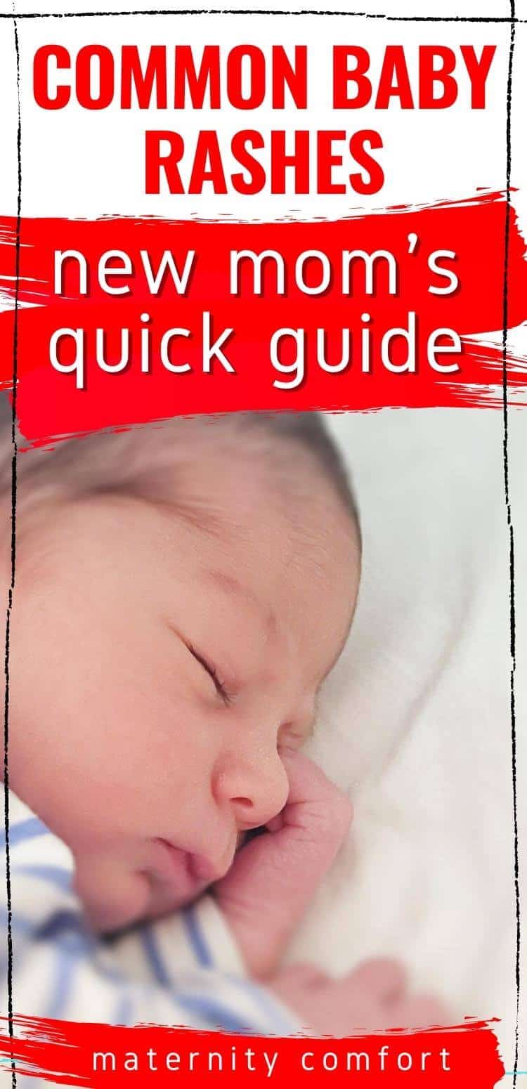 11 Common Baby Rashes: A Mom’s Quick Guide